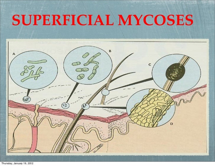 Superficial:cutaneous mycoses