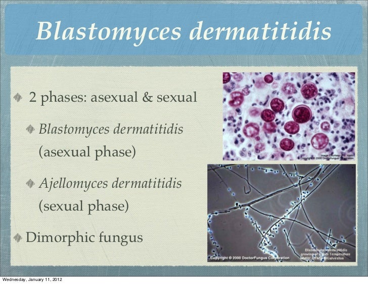 Systemic Mycoses