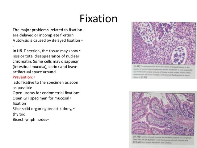Technical faults in histopathology lab