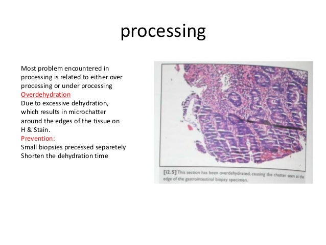 Technical faults in histopathology lab