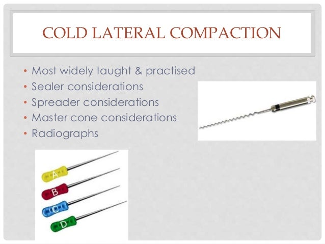 Techniques of Root Canal Obturation