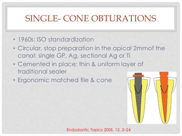 Techniques of Root Canal Obturation