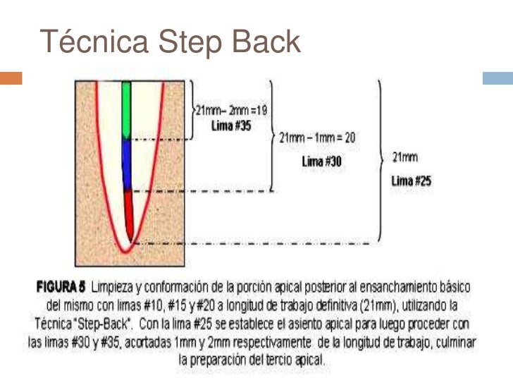 Tecnicas apico y corono apicales