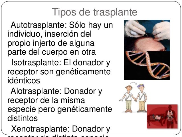 Trasplante De órganos Power Point