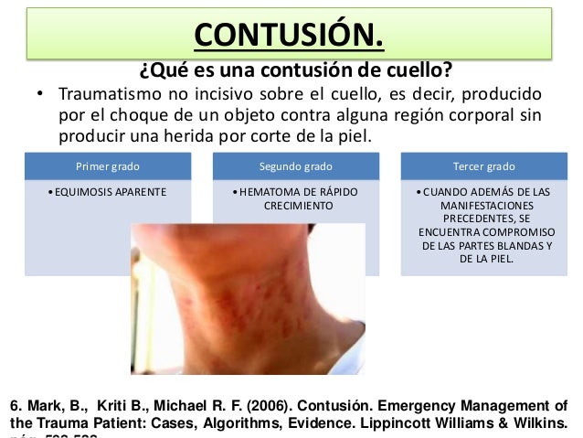 Traumatismos, heridas y contusiones de cuello.