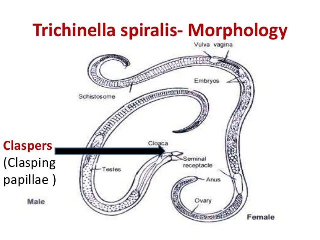 Trichinella spiralis