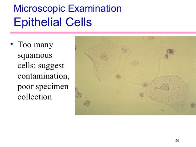 Urinalysis urinalysis