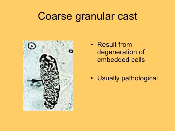 Cme Urinalysis