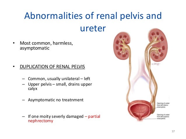 Urinary system embryology