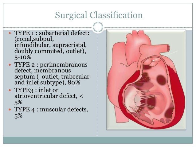 Ventricular septal defects