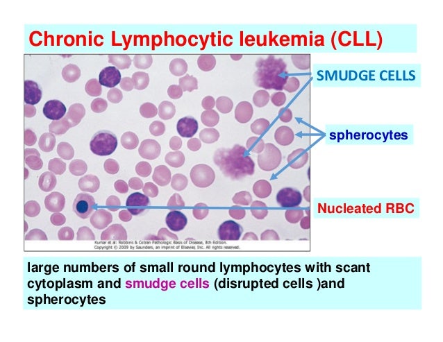 Wbc disoders practical