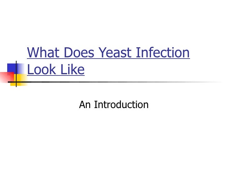 What Does Yeast Infection Look Like