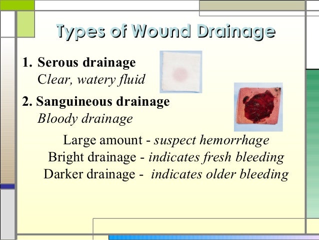 Serous Drainage On Dressing