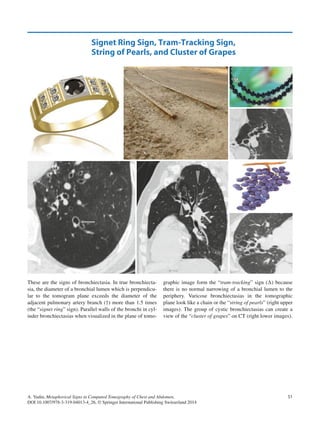 0. metaphorical signs in computed tomography of chest and abdomen | PDF