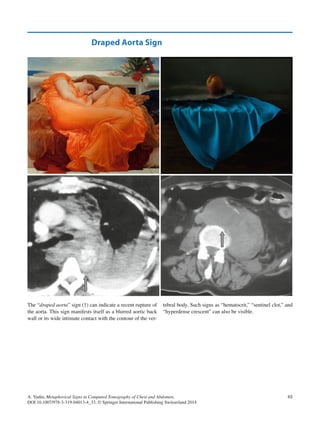 0. metaphorical signs in computed tomography of chest and abdomen | PDF