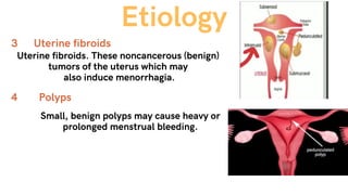Menorrhagia and metorrhagia | PDF