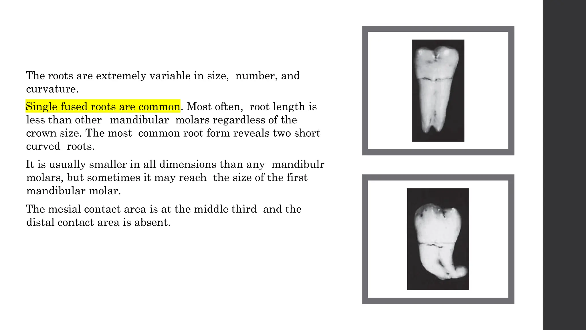 0.. MAIN LEC mandibular 2nd & 3rd molar.pptx