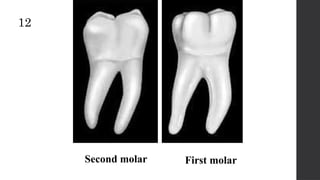 0.. MAIN LEC mandibular 2nd & 3rd molar.pptx