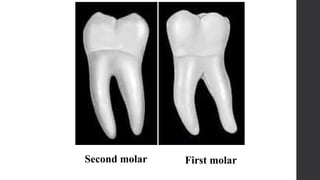 0.. MAIN LEC mandibular 2nd & 3rd molar.pptx