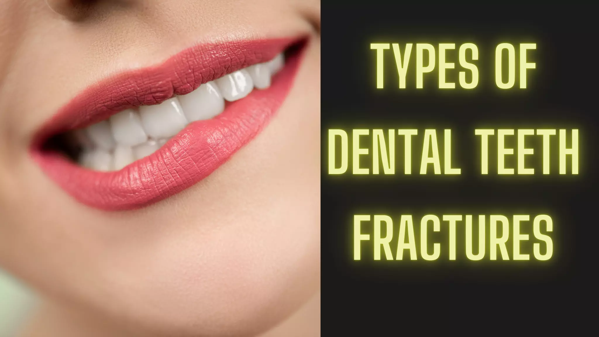 Types Of Dental Teeth Fractures | PPT