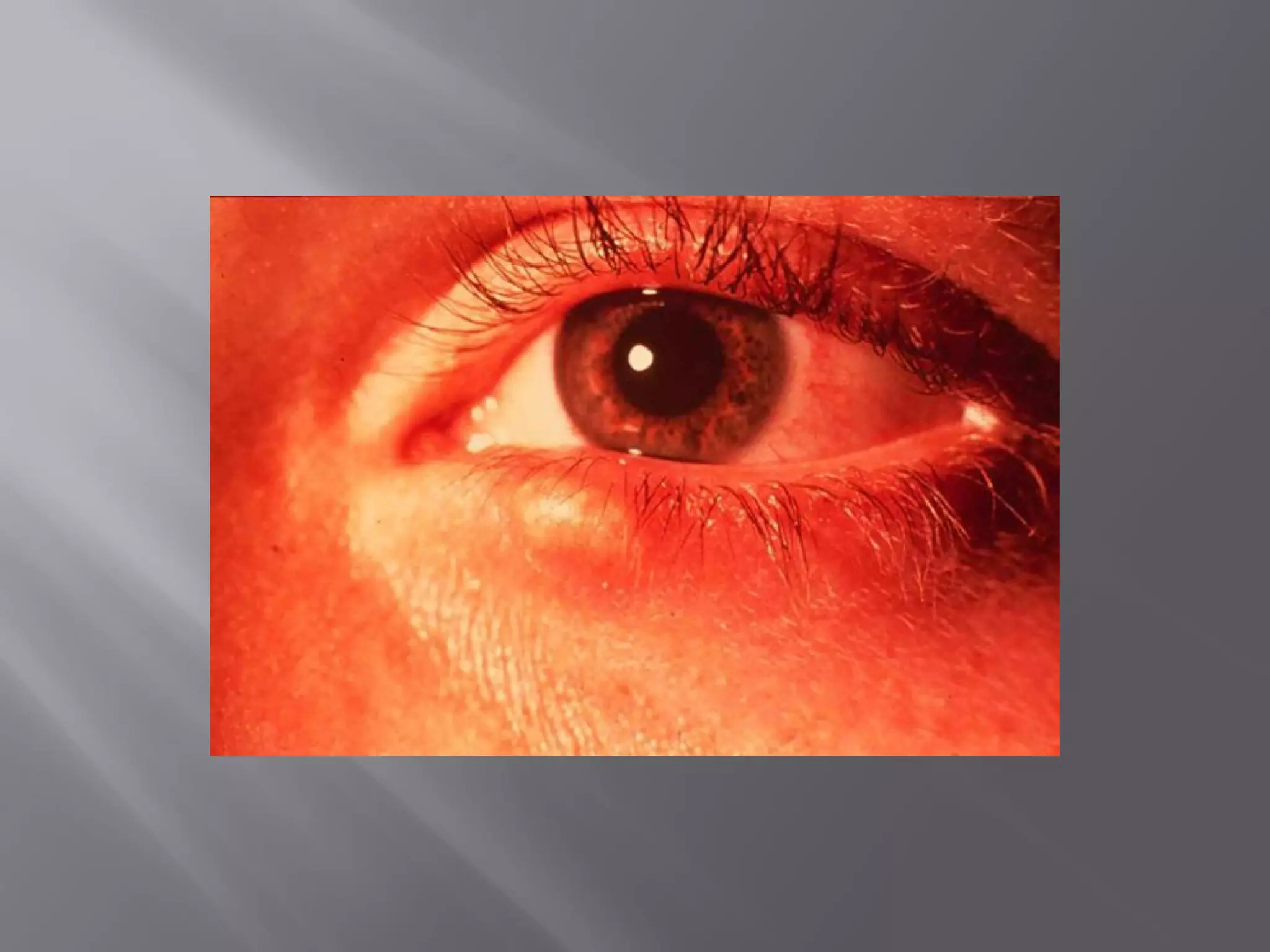 Introduction to ophthalmology | PPT