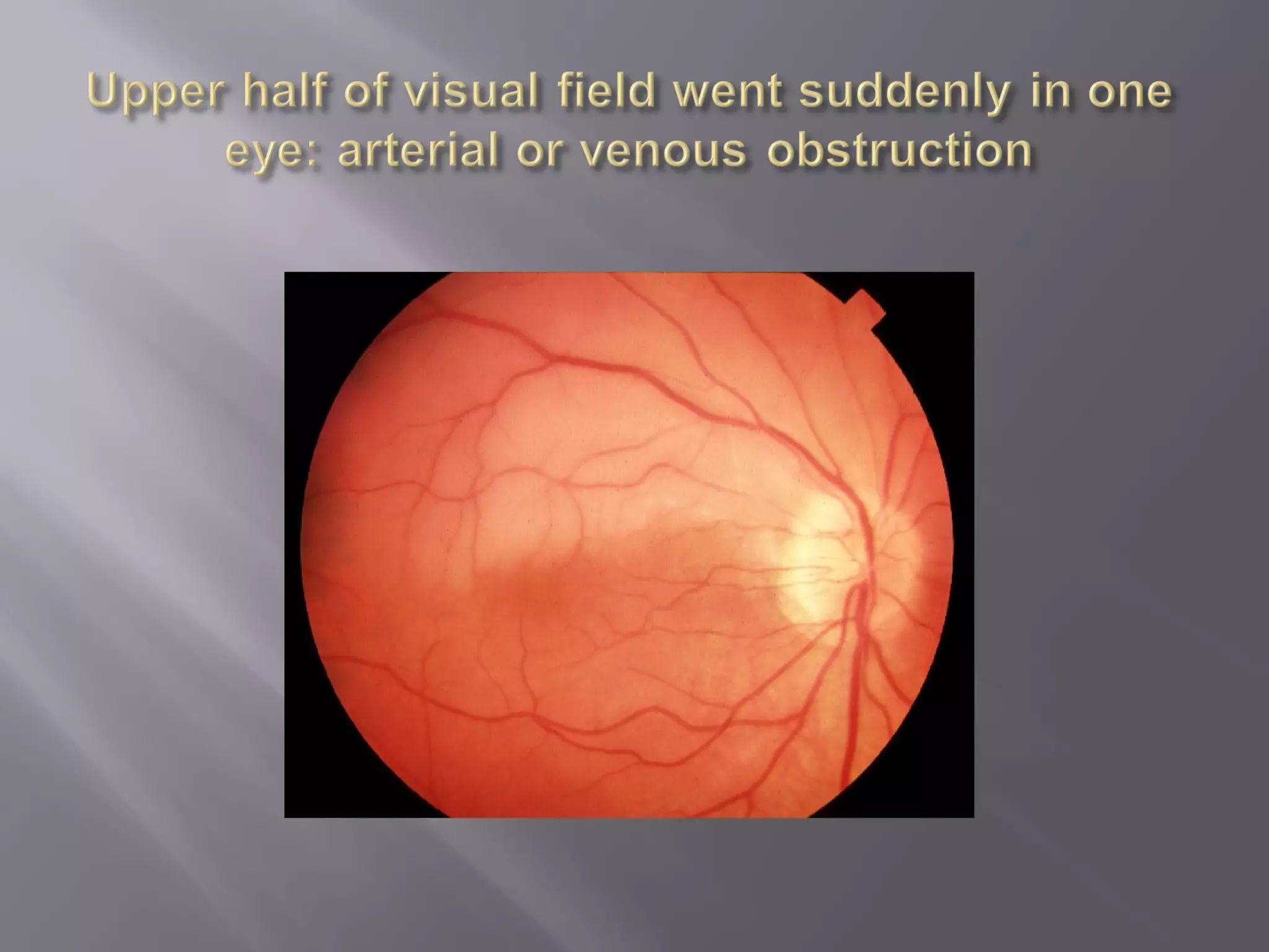 Introduction to ophthalmology | PPT