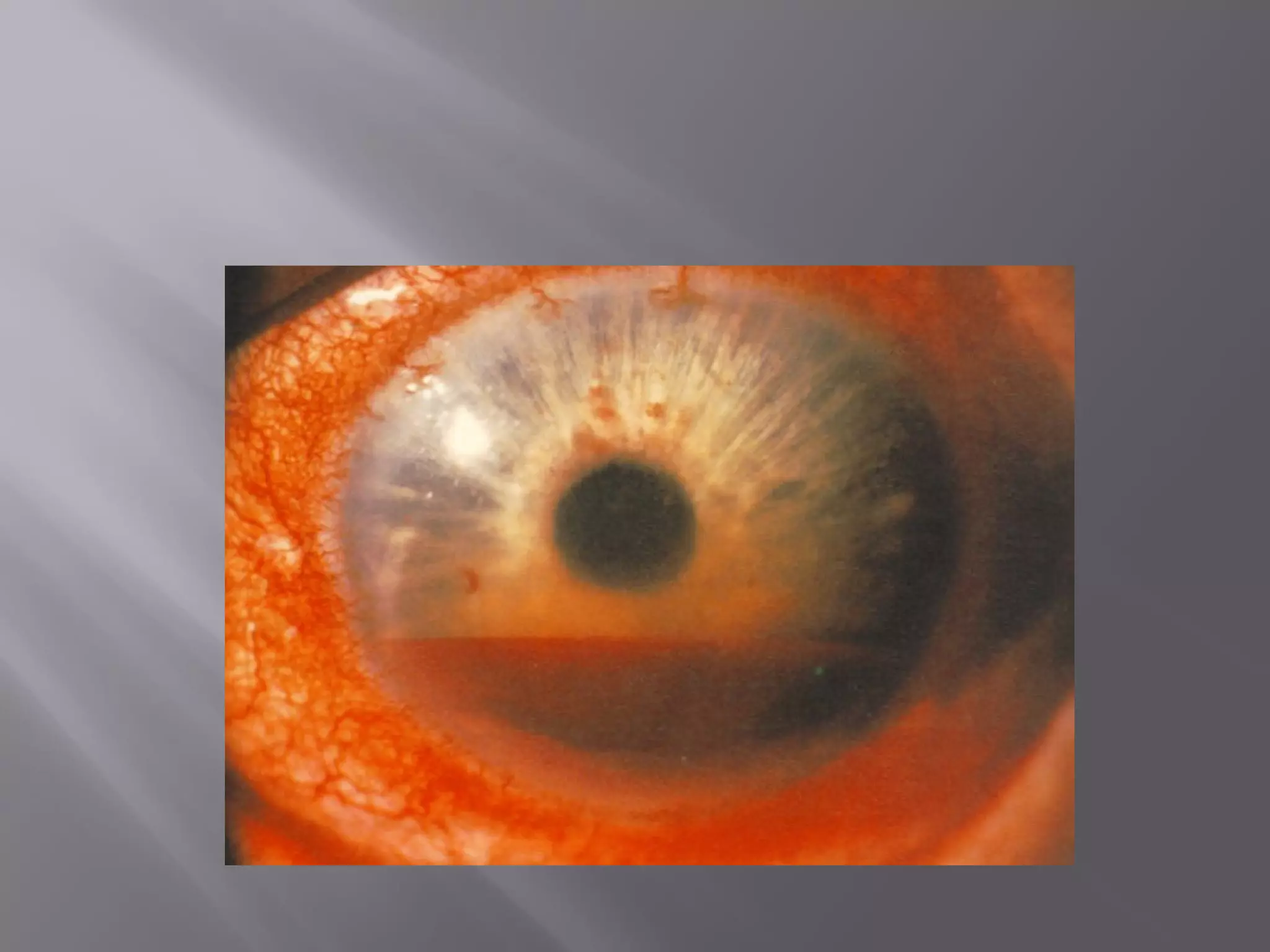 Introduction to ophthalmology | PPT