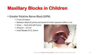 0 local anesthesia in children | PDF