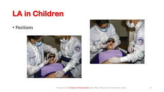 0 local anesthesia in children | PDF