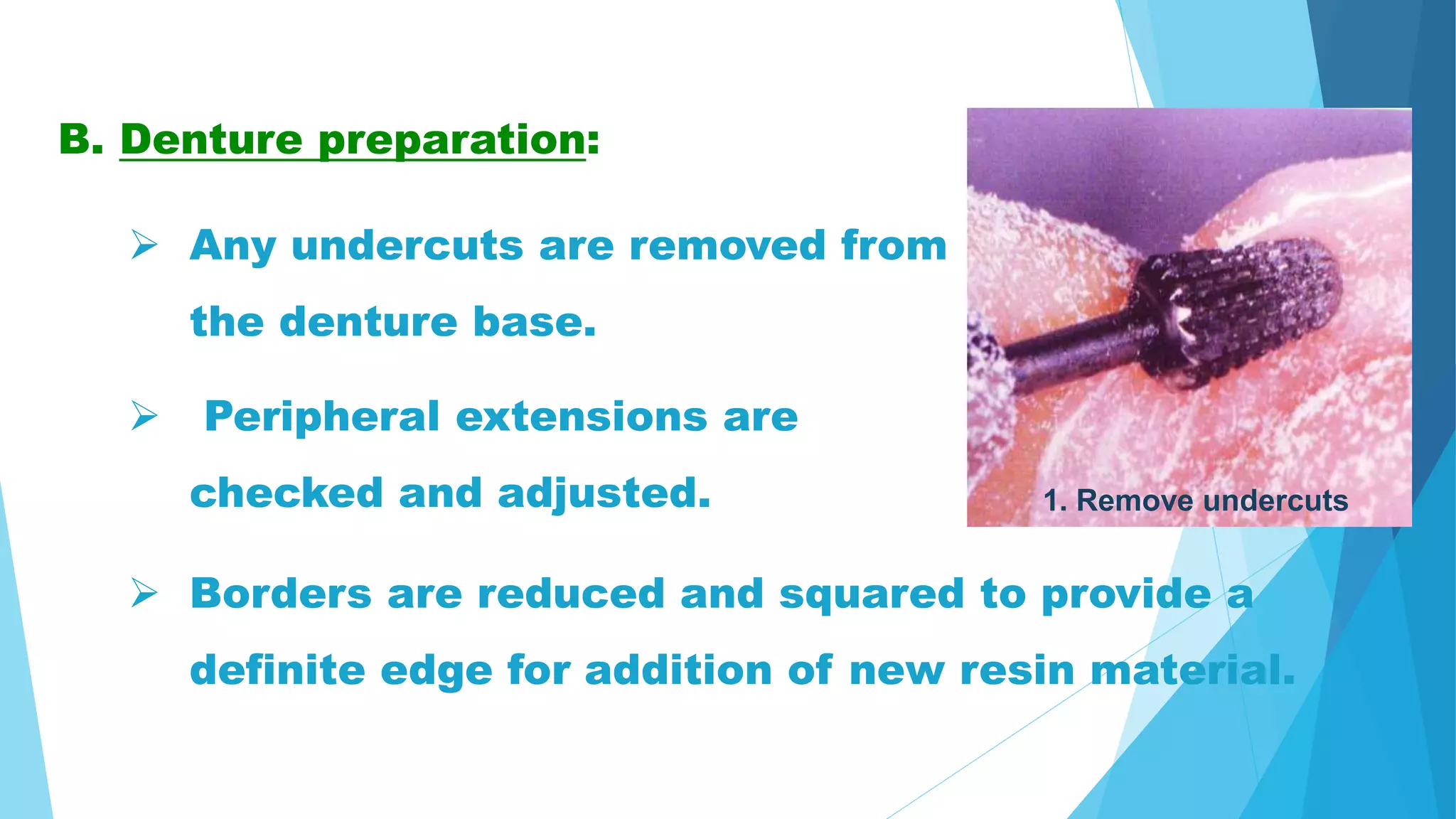 13- Relining, rebasing and repair of removable dentures.pptx