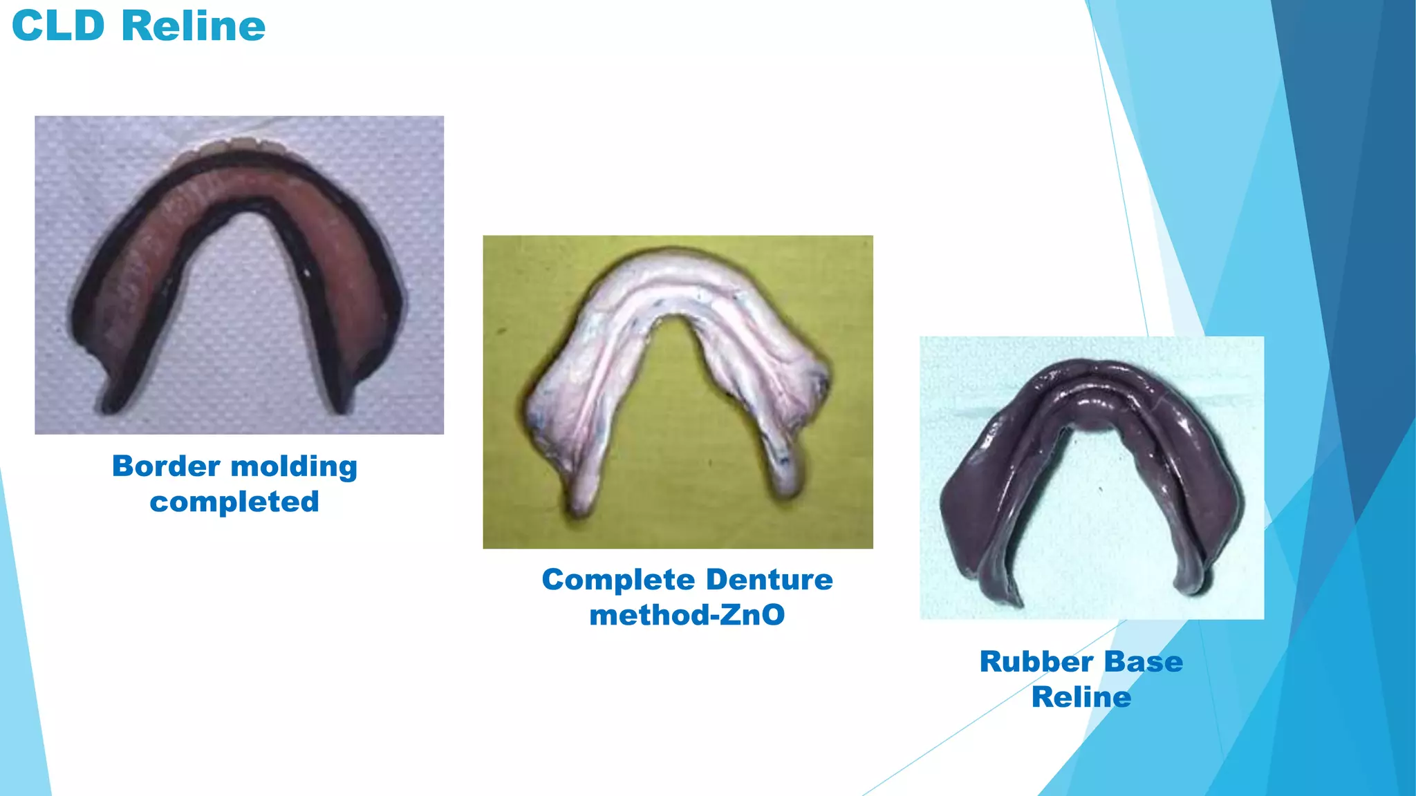 13- Relining, rebasing and repair of removable dentures.pptx
