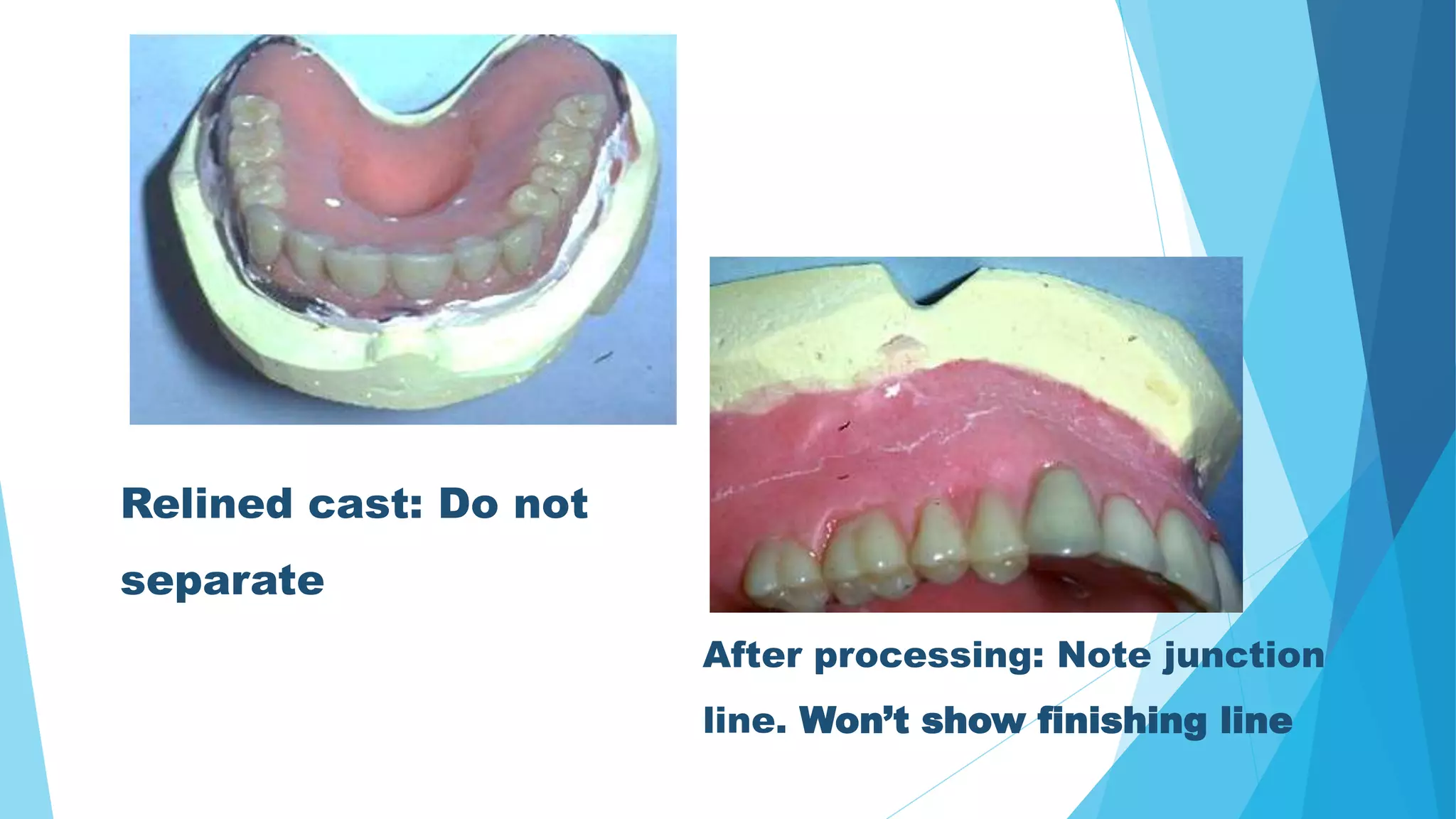 13- Relining, rebasing and repair of removable dentures.pptx