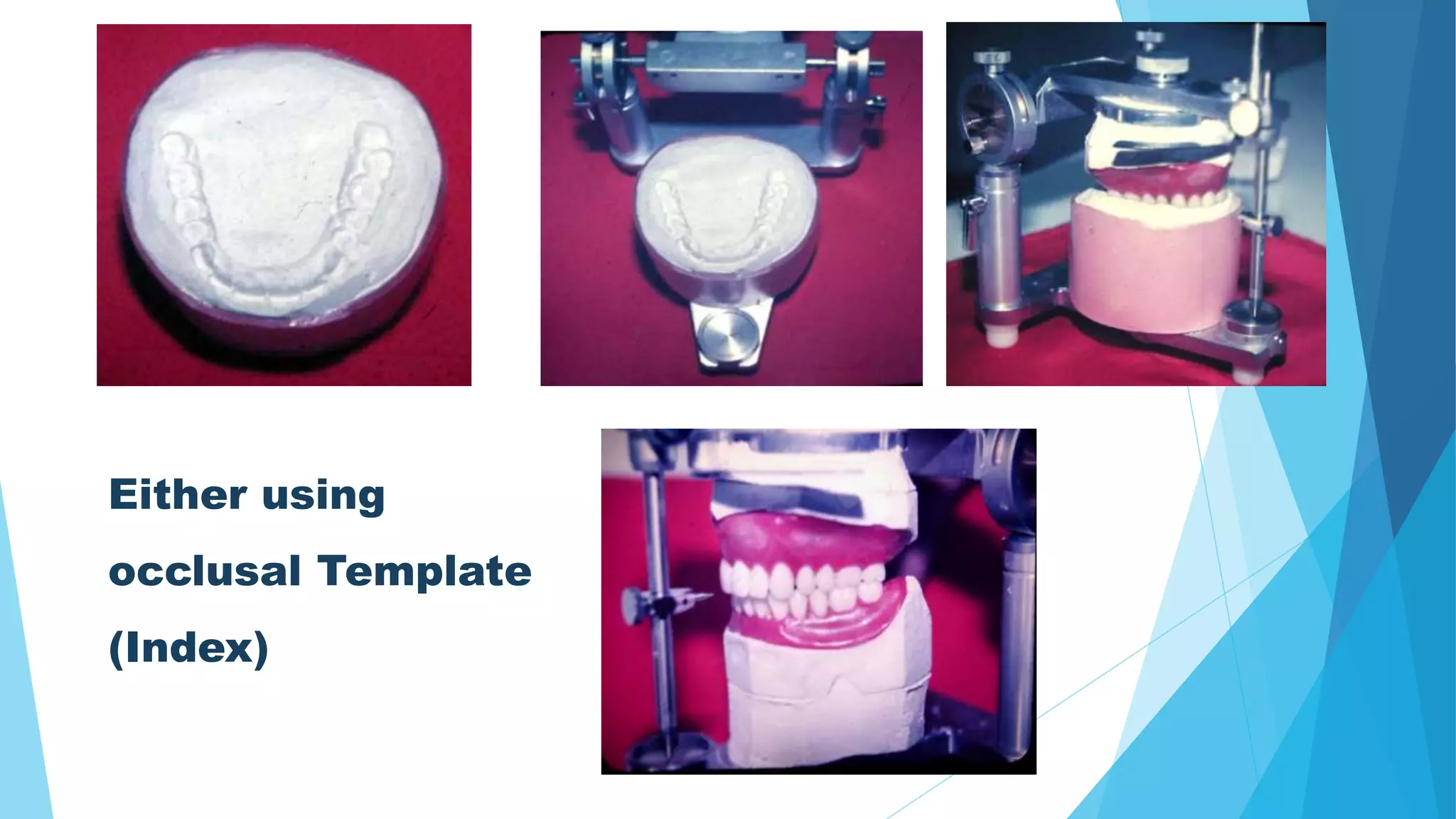 13- Relining, rebasing and repair of removable dentures.pptx