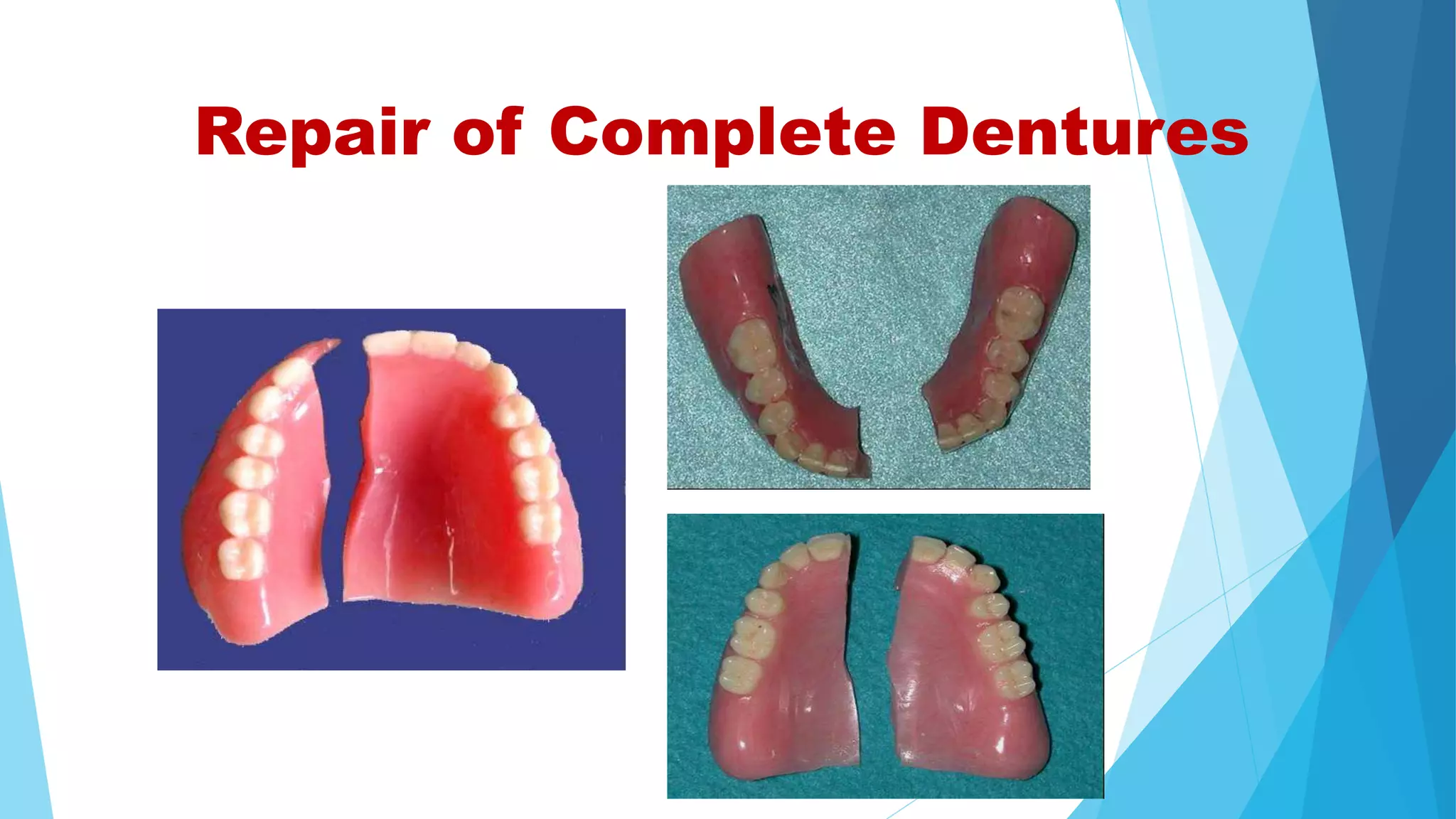 13- Relining, rebasing and repair of removable dentures.pptx