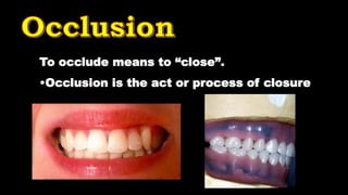 01- Occlusion in prosthodontics introduction -5th year | PPTX
