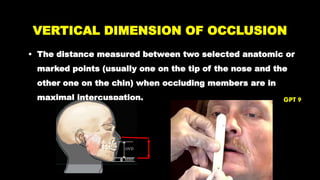 01- Occlusion in prosthodontics introduction -5th year | PPTX