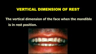 01- Occlusion in prosthodontics introduction -5th year | PPTX