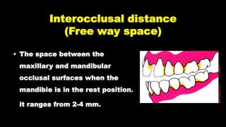 01- Occlusion in prosthodontics introduction -5th year | PPTX