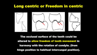 01- Occlusion in prosthodontics introduction -5th year | PPTX