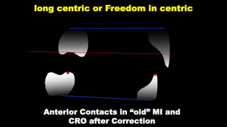 01- Occlusion in prosthodontics introduction -5th year | PPTX