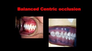 01- Occlusion in prosthodontics introduction -5th year | PPTX