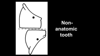 01- Occlusion in prosthodontics introduction -5th year | PPTX