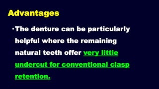Other forms of removable partial denture | PPTX