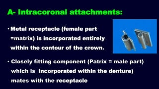 Other forms of removable partial denture | PPTX