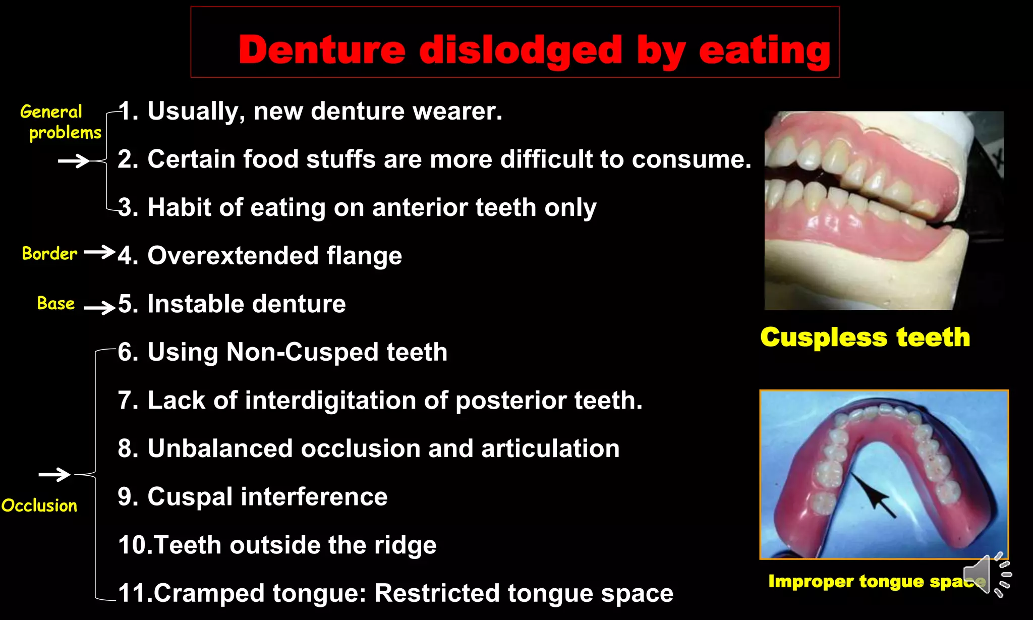 Revision of Complete Denture Occlusion 5th year | PPTX