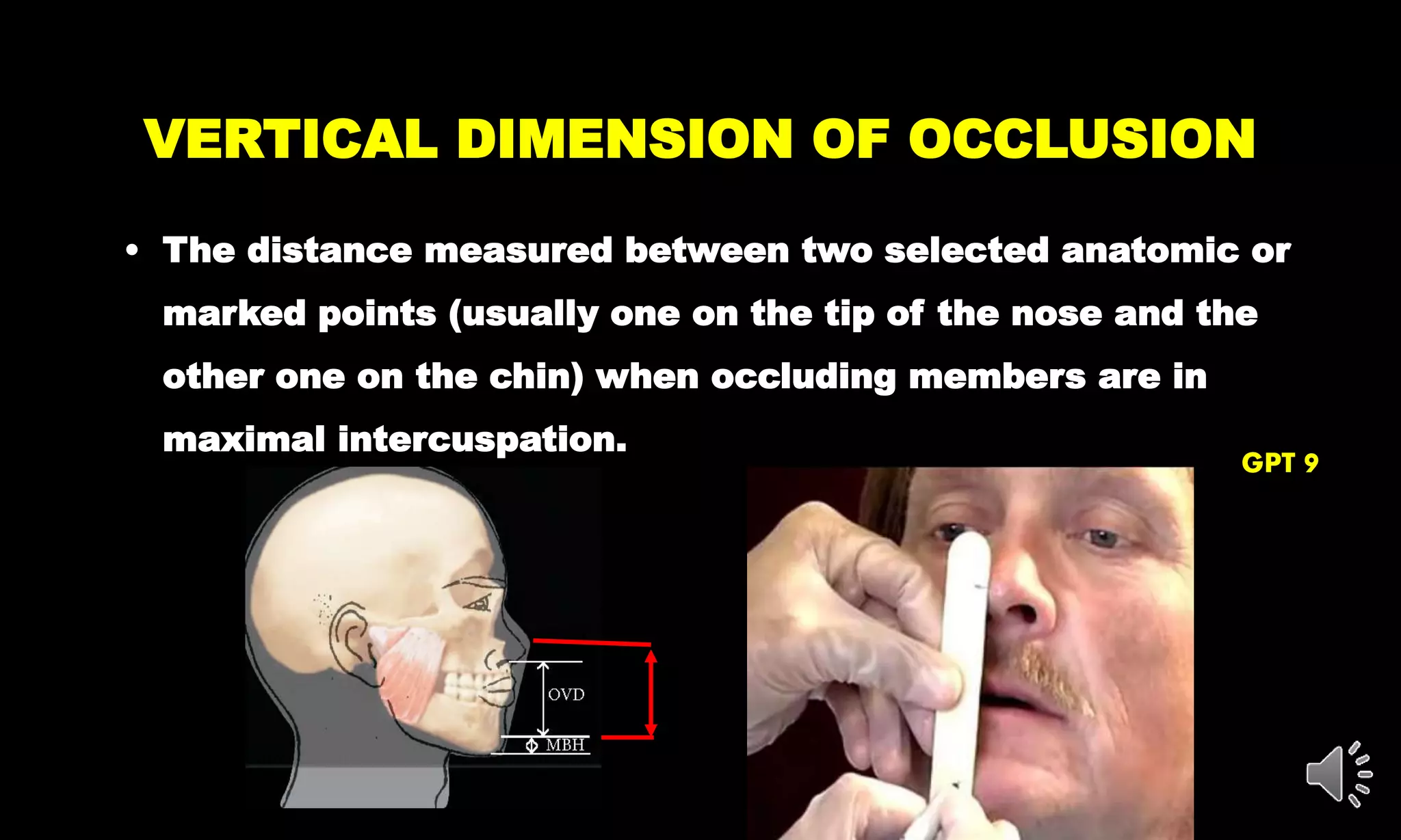 00- Revision of occlusion 5th year.pptx