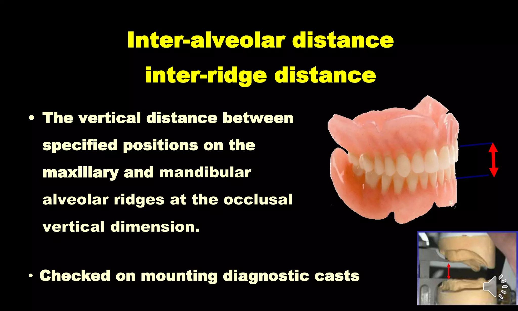 00- Revision of occlusion 5th year.pptx