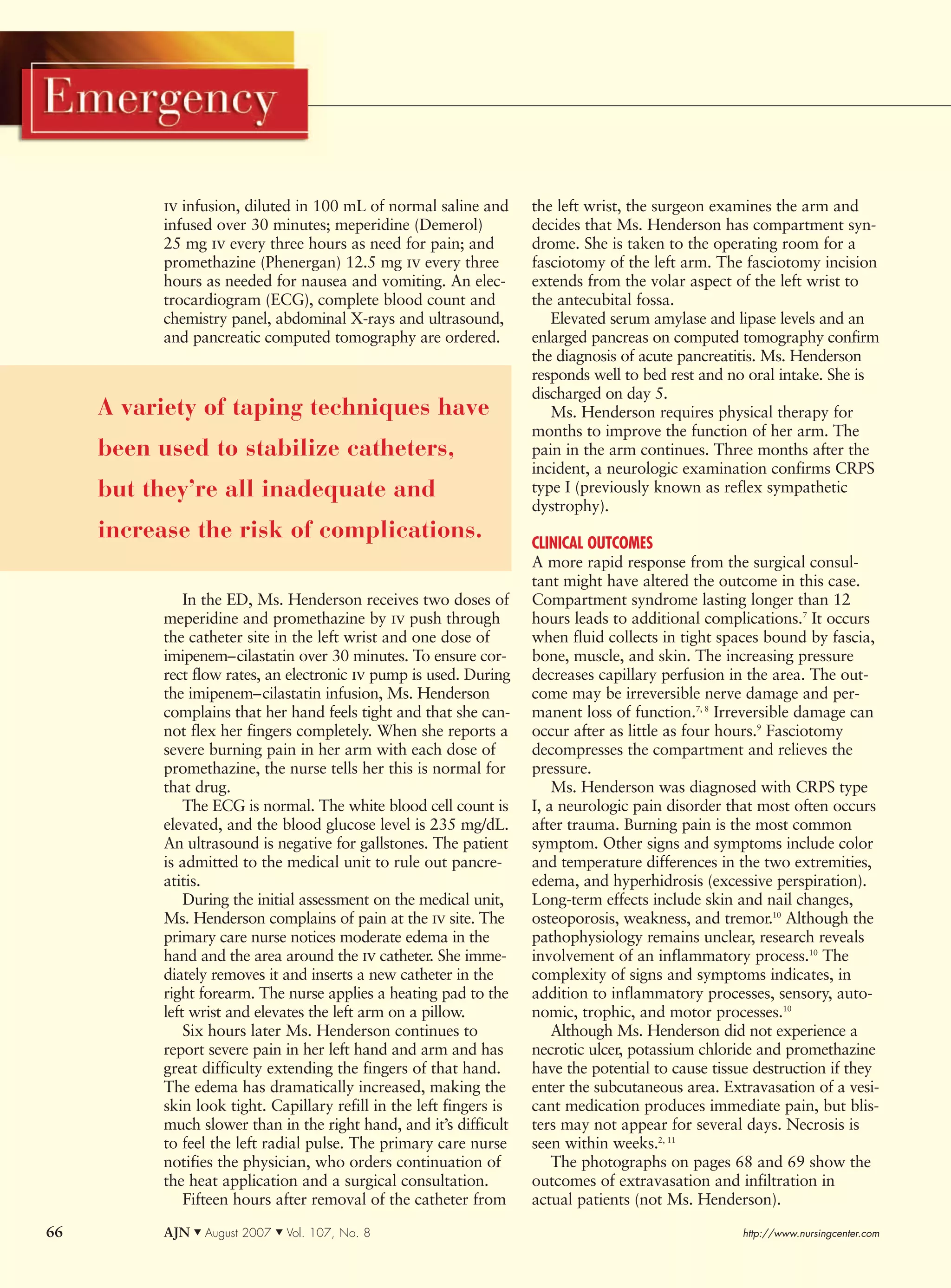 Infiltration and Extravasation-Preventing a complication of IV ...