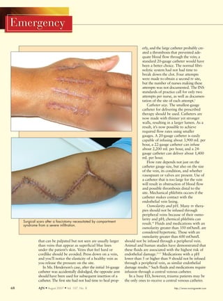 Iv Infiltration Vs Extravasation