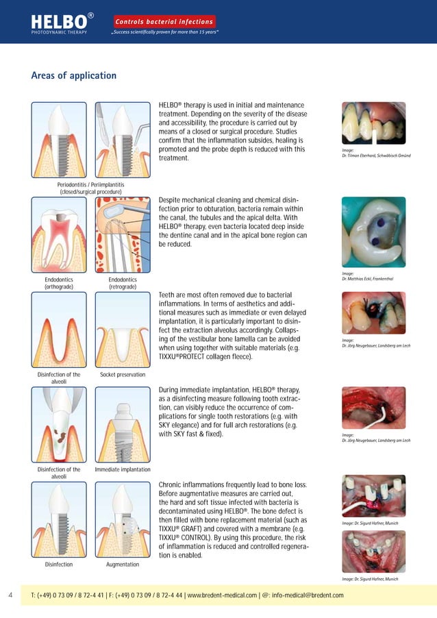 000429GB_Helbo Treatment.pdf